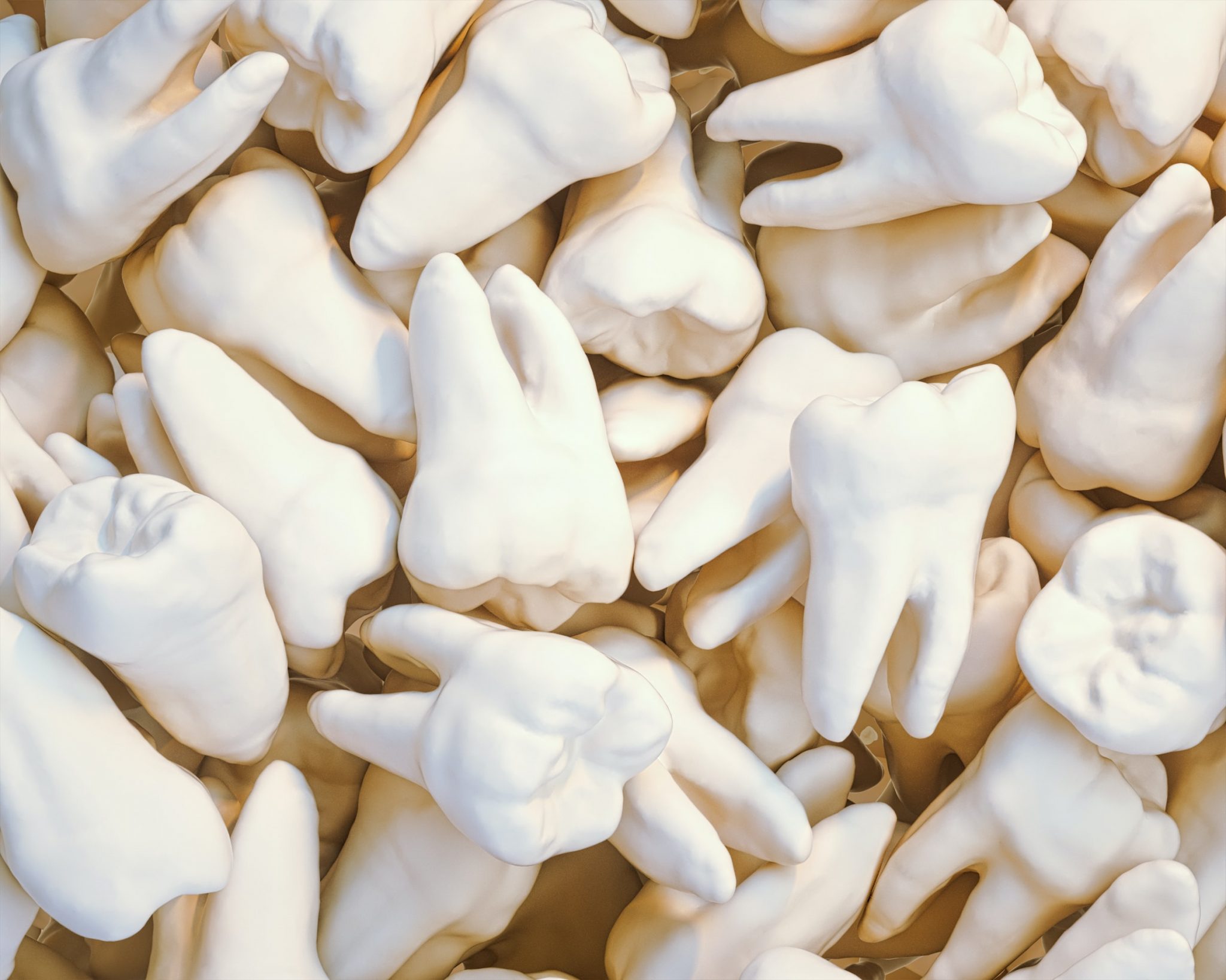 Enamel demineralization – symptoms, causes, and how to restore tooth ...