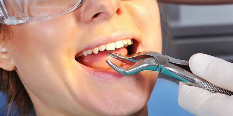 When does the blood clot fall out after tooth extraction and how to ...